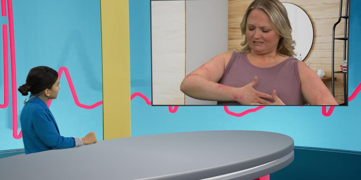 Herbe à puce | Télé bobos | TFO